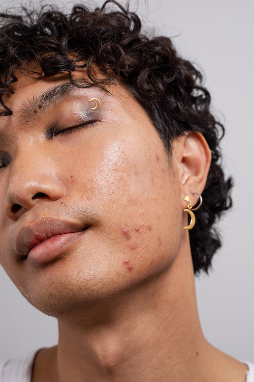 Guide: Så tar du reda på vilken hudtyp du har – Common Clouds