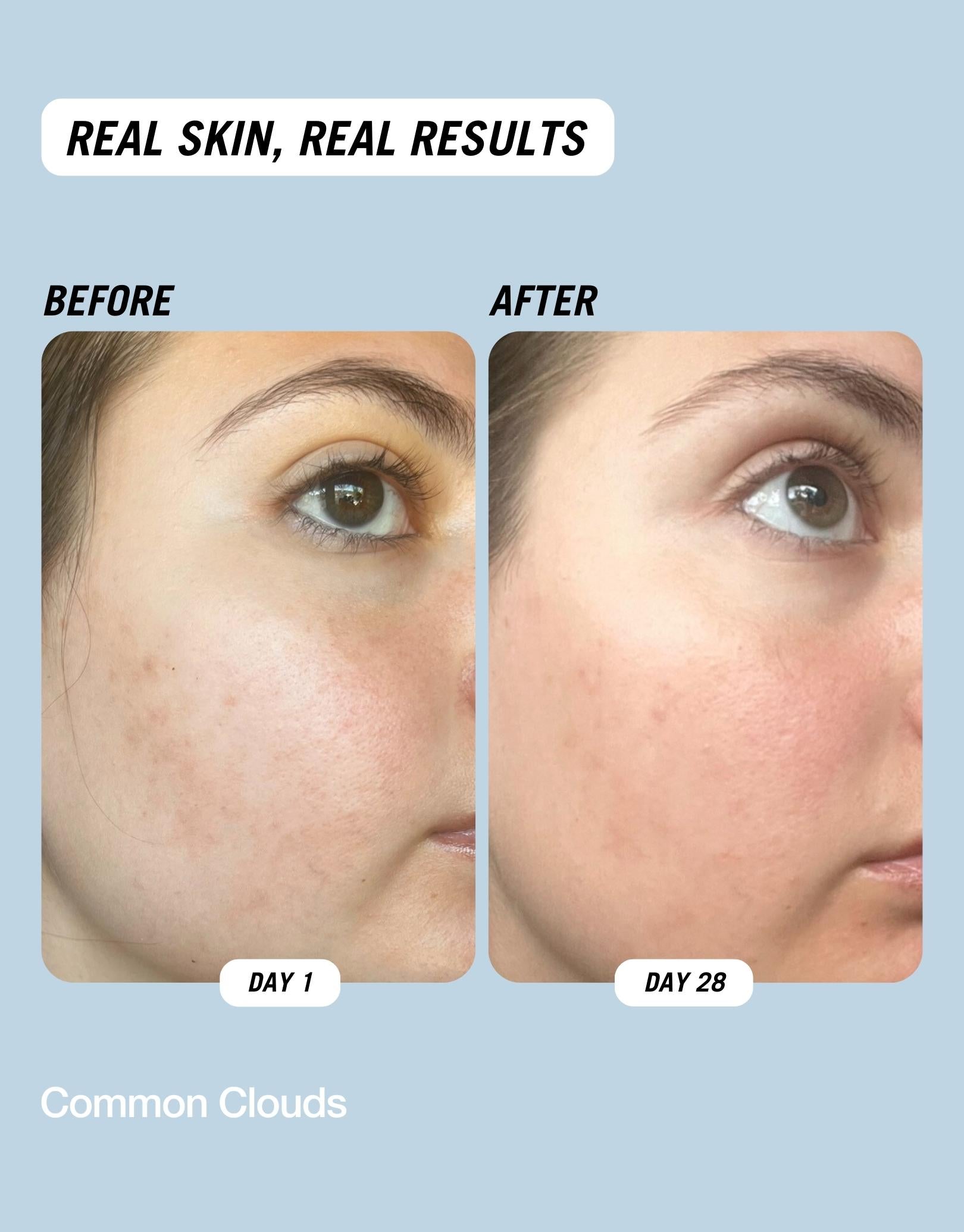 Cloud Water – Gentle exfoliating 2% BHA toner – Common Clouds