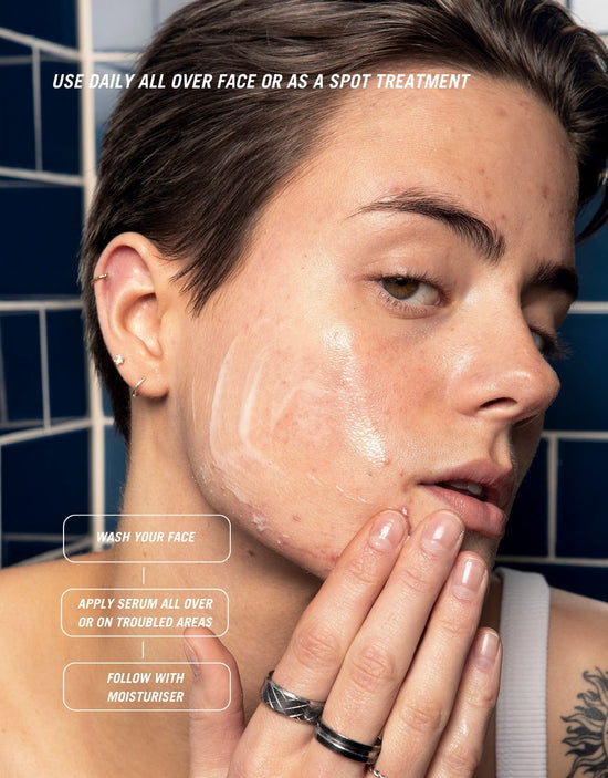 Cloud Milk – Serum för aknebenägen, känslig hud – Common Clouds